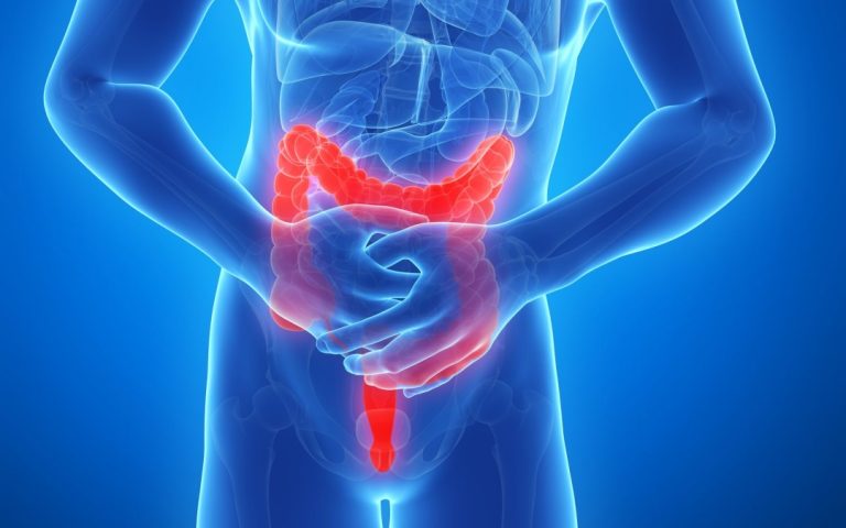 Ontlastingsonderzoek geeft inzicht in de disbalans van de darm